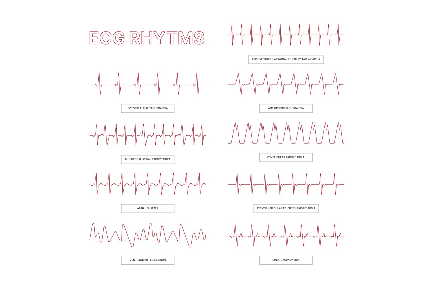 Ecg templates. Medical infographic lines heart arrhythmia he (1793314 ...