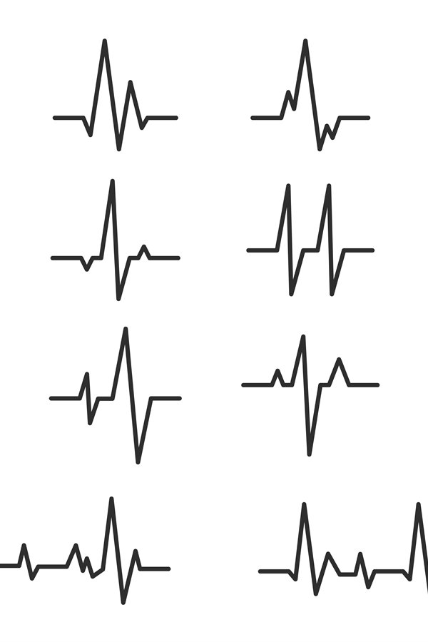 Ecg. Sinusoidal pulse lines, frequency heartbeat stress test