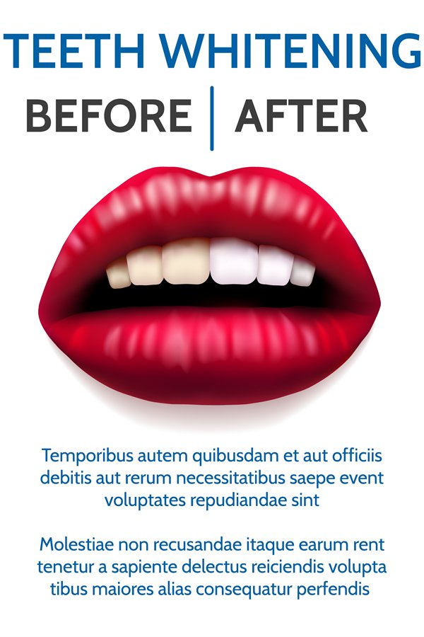 Teeth whitening poster (1247095)