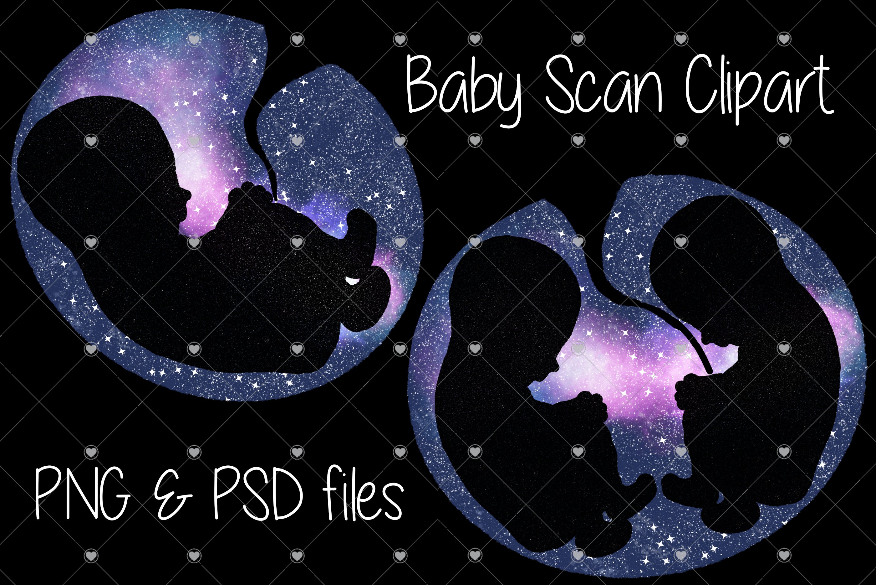 Baby, Scan, Rainbow baby, Pregnancy, Twins, Babies, Newborn,