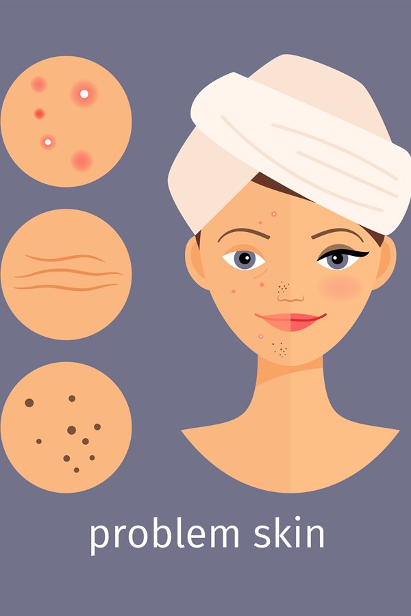 Problem skin vector illustration