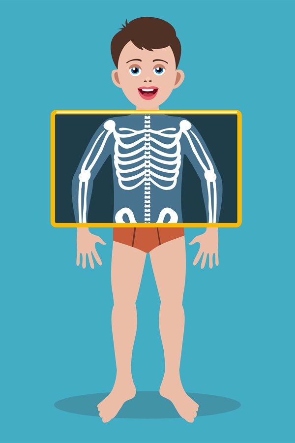 Cartoon x-rays bones scan