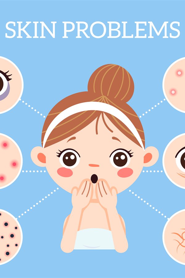 Skin problems infographic. Ages wrinkles problems, blackhead