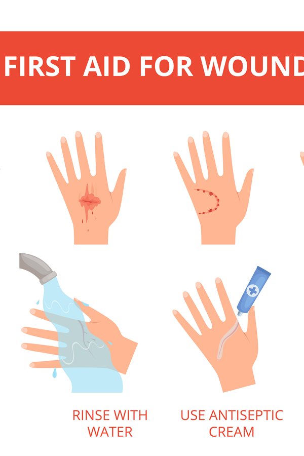 Wound skin treatment. First emergency help for human hand tr