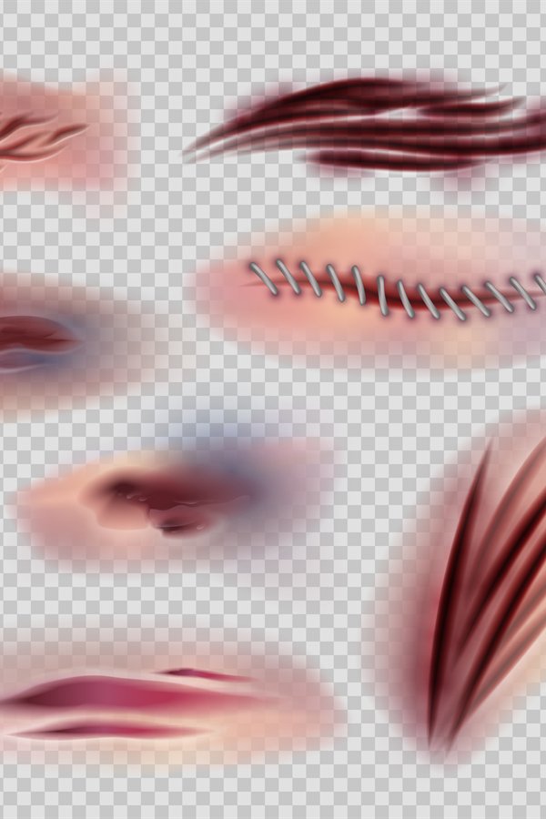 Realistic wounds and stitches. Cut skin and body marks and s