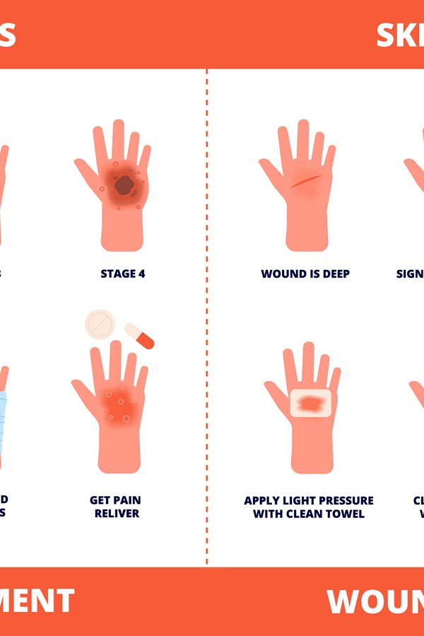 Skin first aid. Burns treatment, wounds and trauma symptoms.