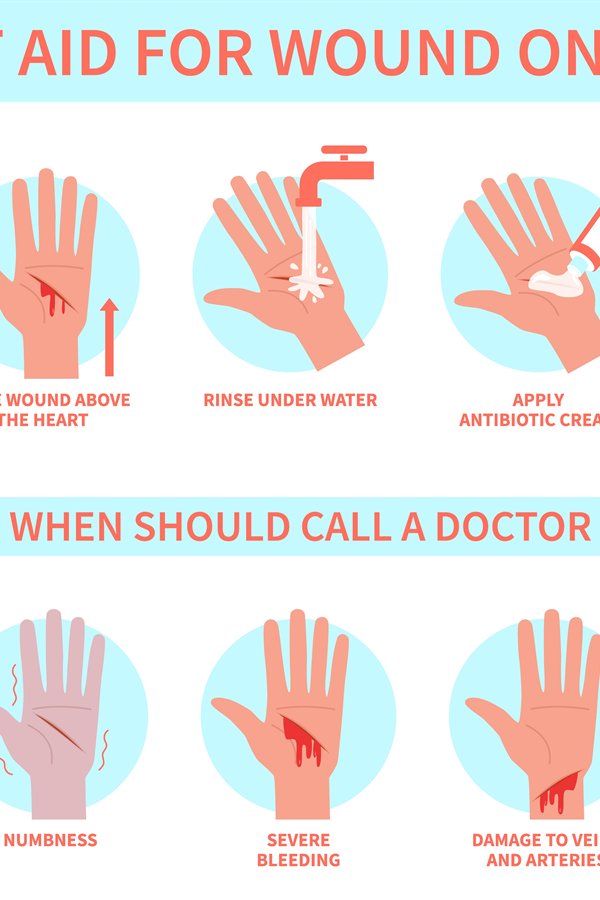 First aid for wound on skin. Damage, bleeding cut hand skin
