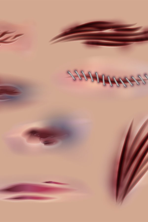 Skin scars and wounds. Surgery stitches and horror wounds on