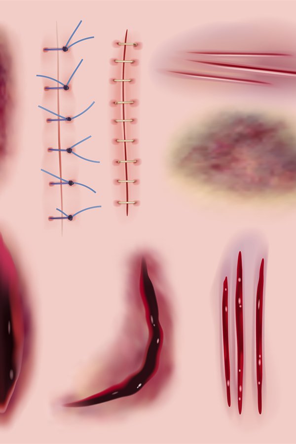 Stitching realistic. Coloring bloody scars cuts different wo