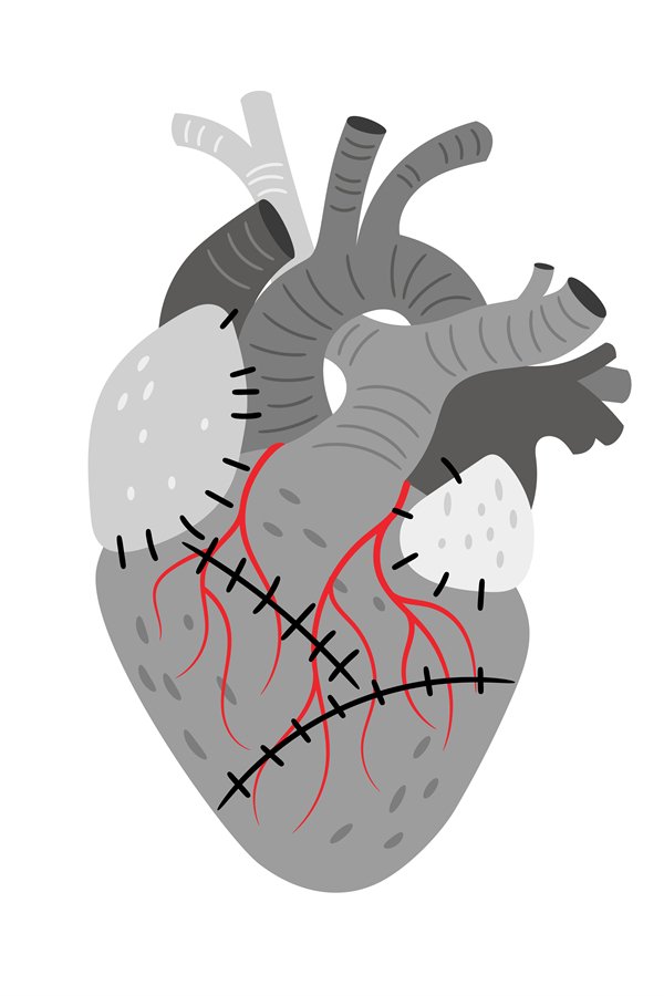 Anatomical organ, heart with stitches