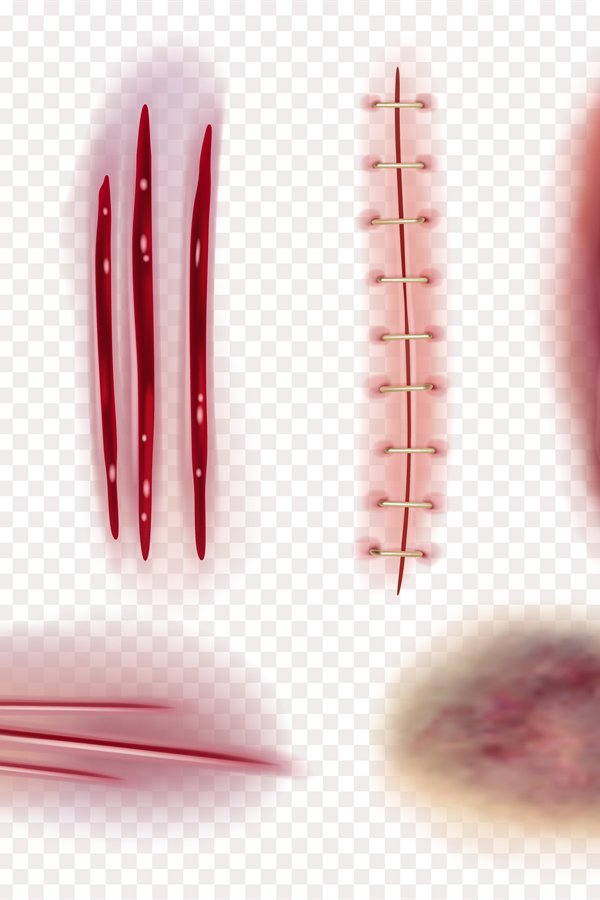 Realistic scars. Cuts wounds bruises bruises blood stitches