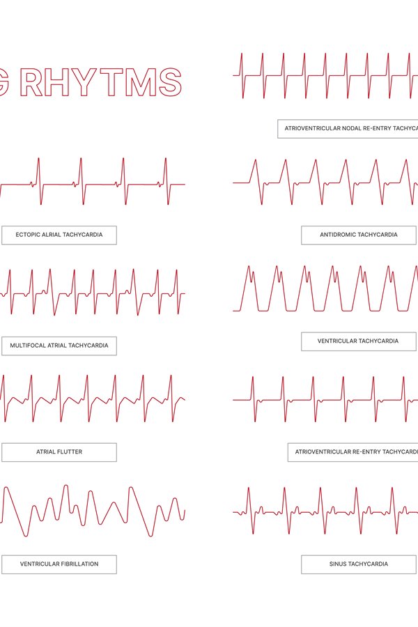 Ecg templates. Medical infographic lines heart arrhythmia he