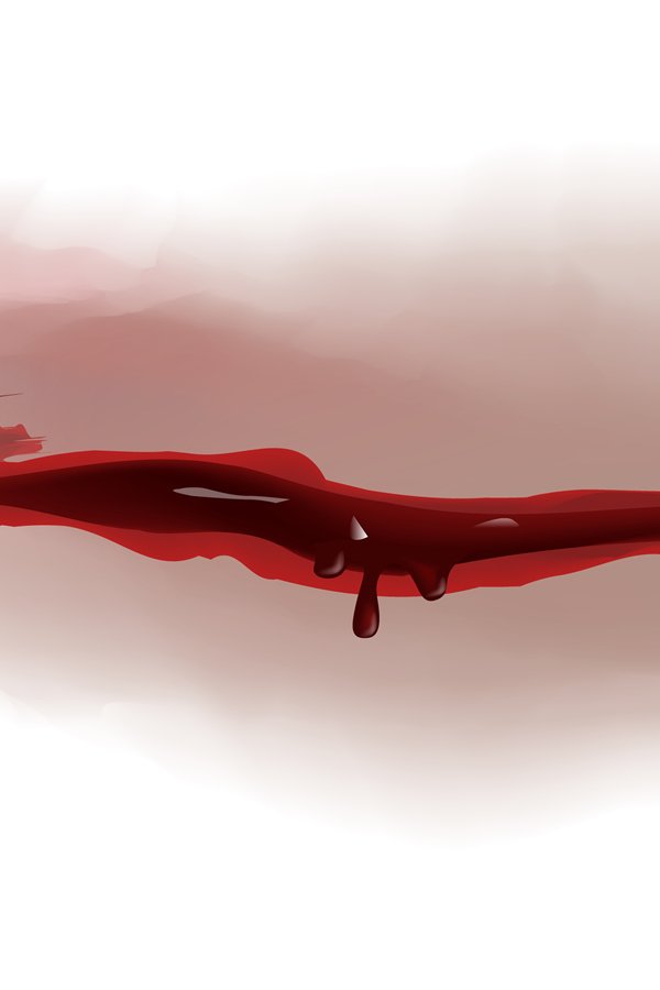 Bloody wound. Realistic torn gash. Skin incision with blood,